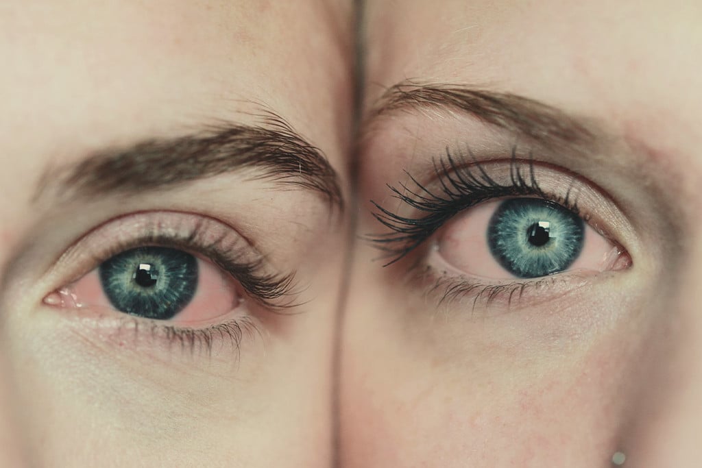 Why Cannabis Causes Red Eyes - RQS Blog