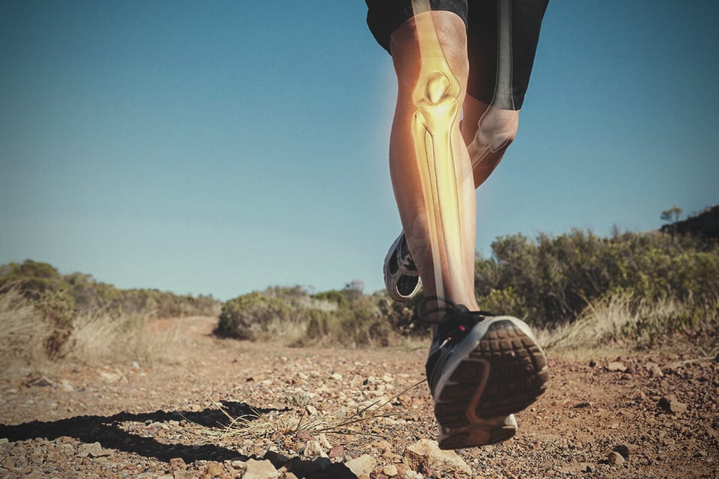 Cannabis for Bone Health: Can It Help? - RQS Blog